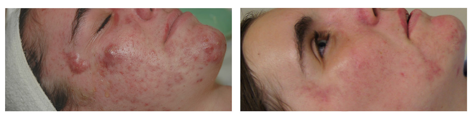 Before and After Photos - Cosmetic Elegance