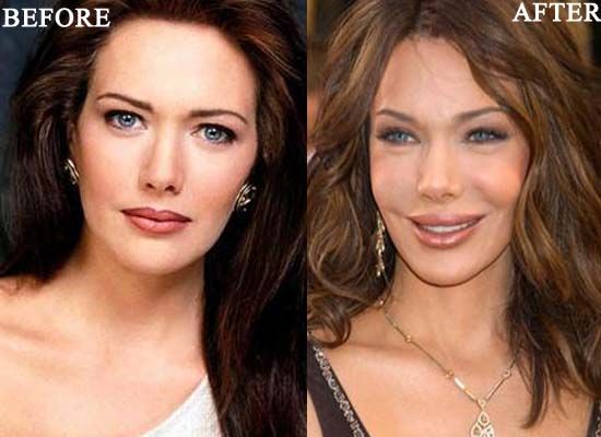 Bad Cosmetic Results - Cosmetic Elegance